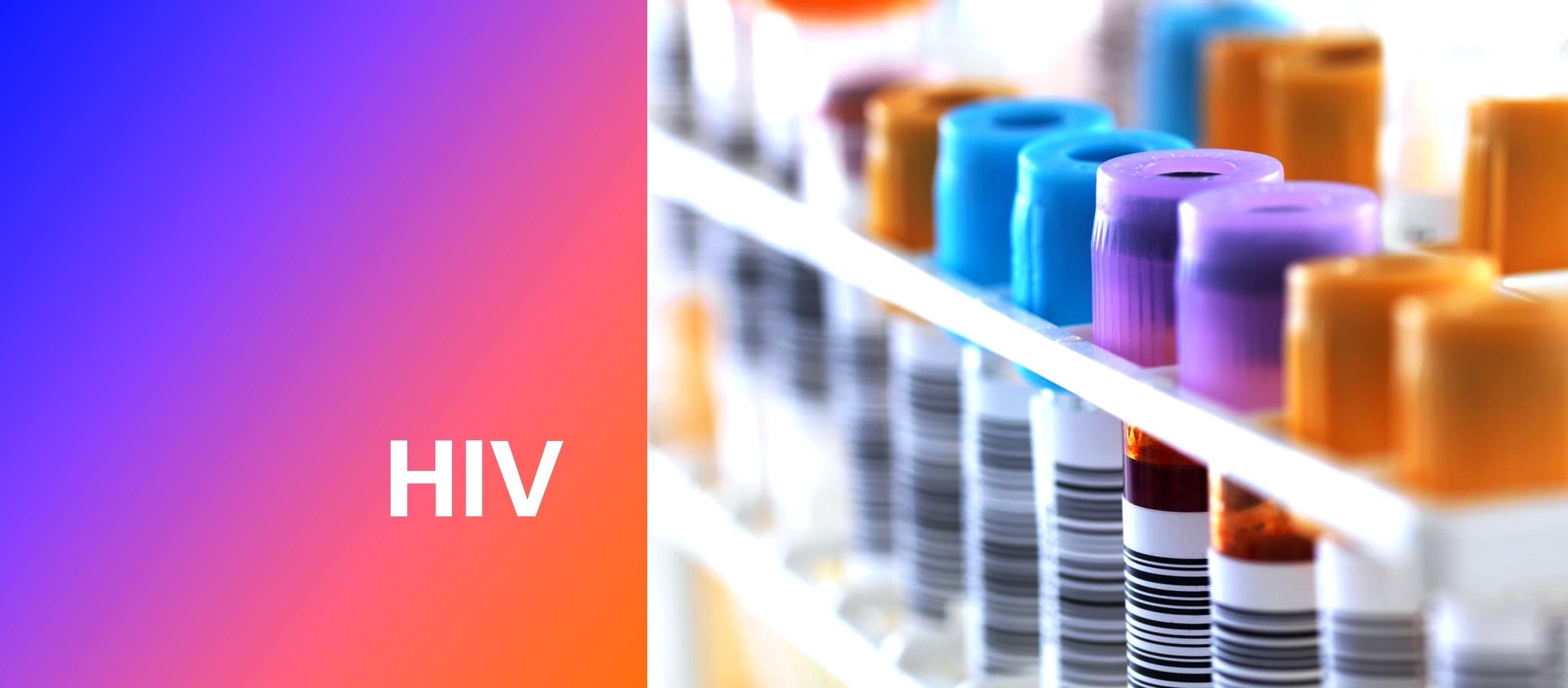 HIV treatment breakthrough – Evening Standard – Scientect